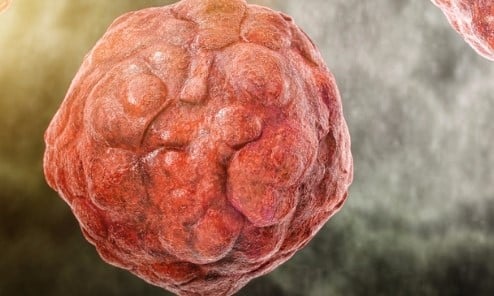 Cell Disruptors | Cell Disruption Technology